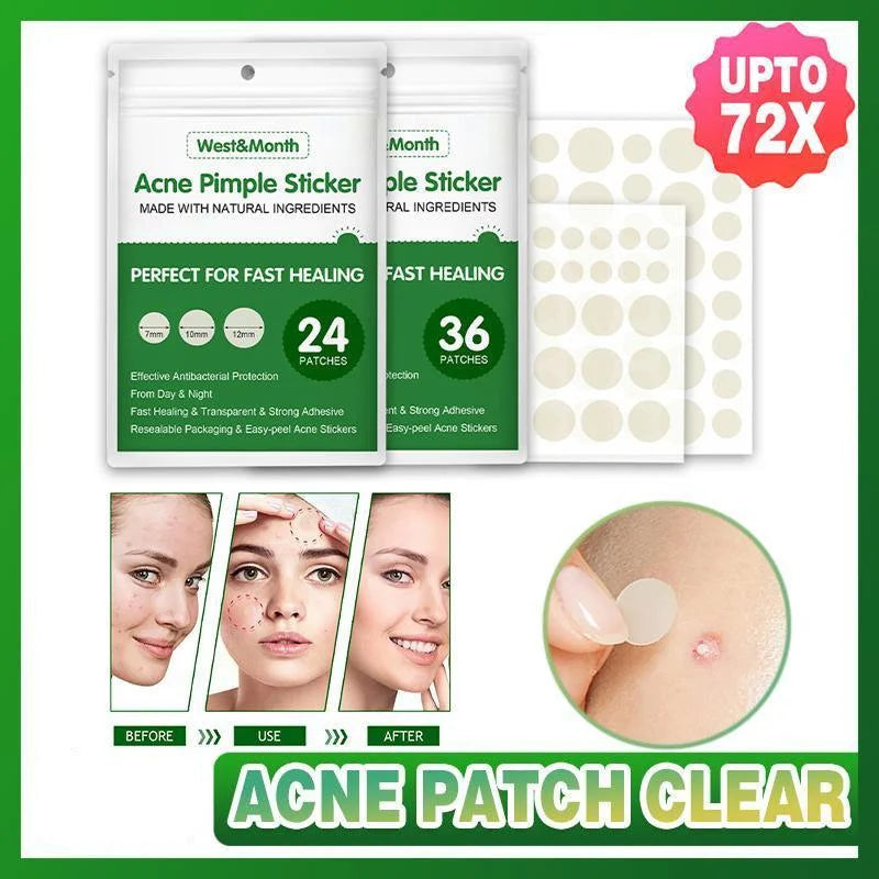 Skin Tag Remover Acne Pimple Patch Removal Facial Care Spot Plaster ...